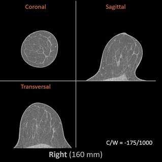 Be The First Clinic With This Innovative Breast Scanner