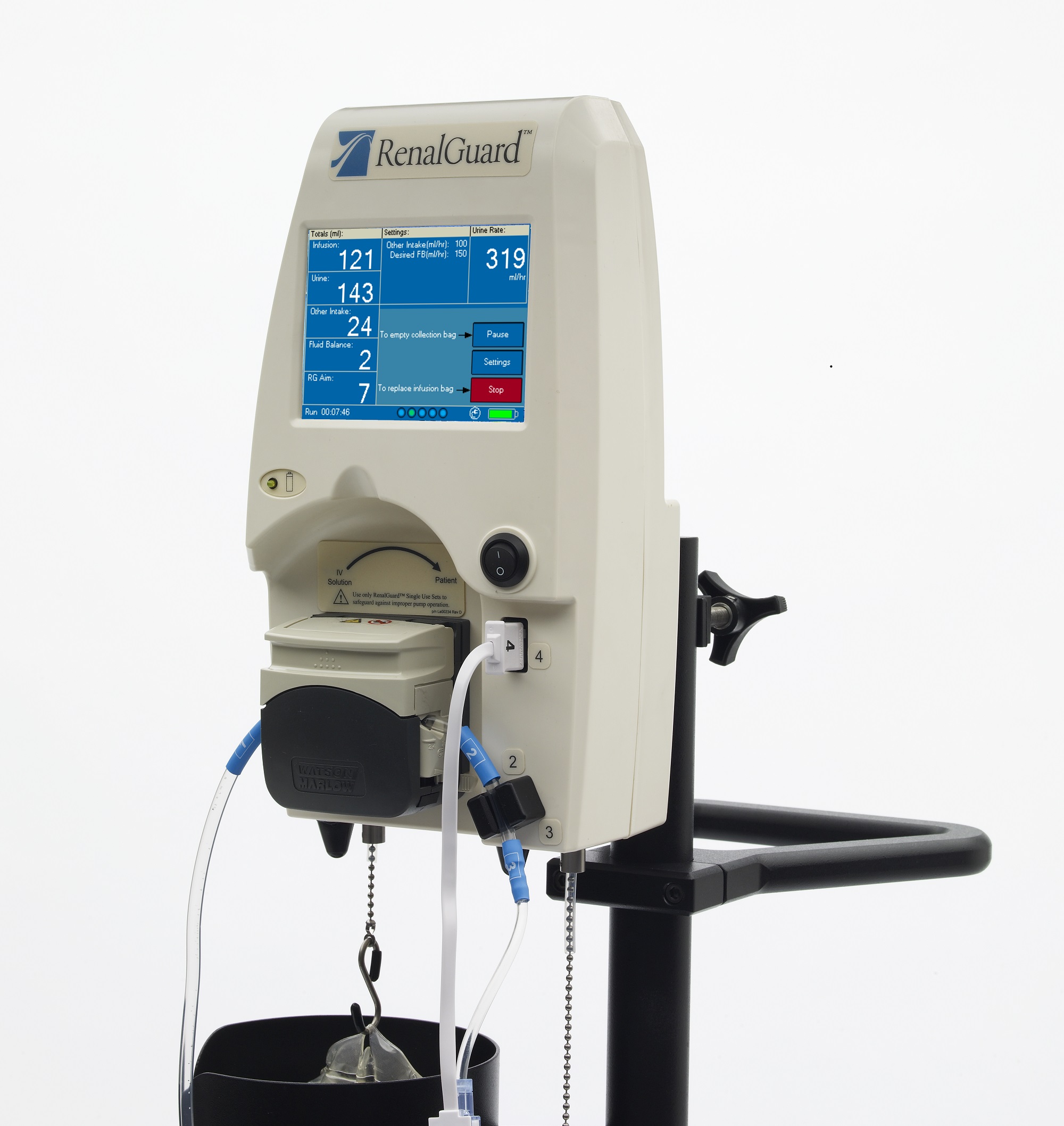 RenalGuard reduces acute kidney injury